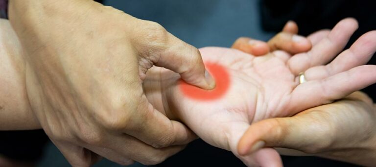 Trigger Point Release Therapy in Lee's Summit, MO